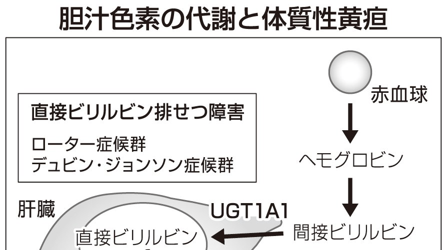 体質性黄疸 先天的な代謝異常症で出現 | 岐阜新聞デジタル